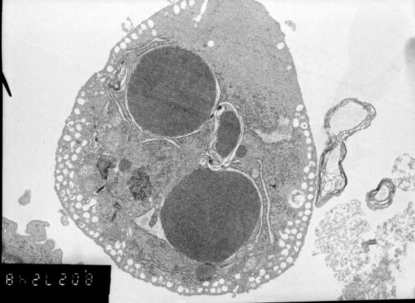 Apoptose cellulaire et nécrose cellulaire - Mort cellulaire programmée ...
