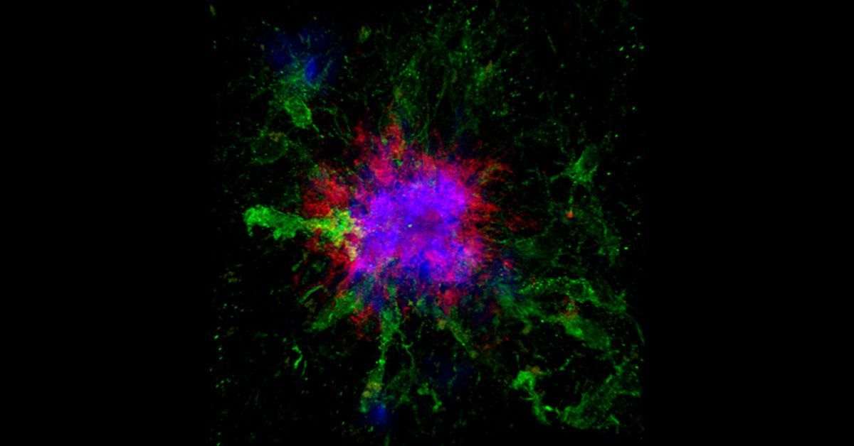 Lien surprenant entre la Maladie d’Alzheimer et le jeûne intermittent ...