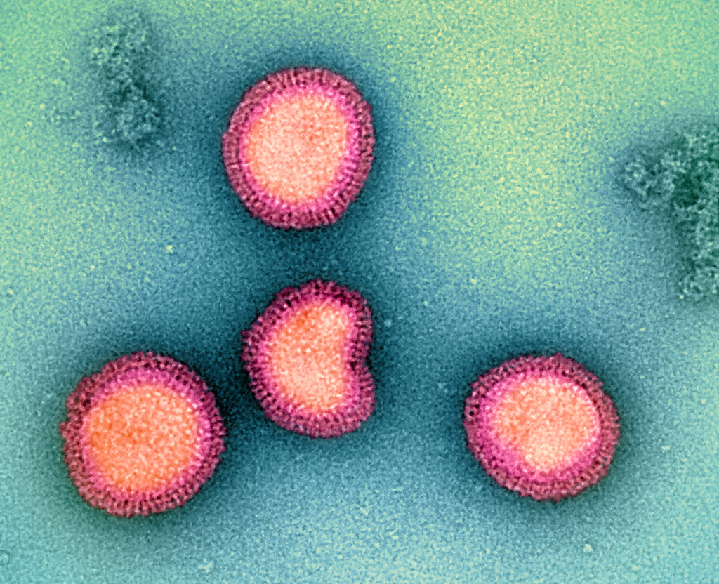 Liens étroits entre les virus et la maladie d’Alzheimer semblent se ...